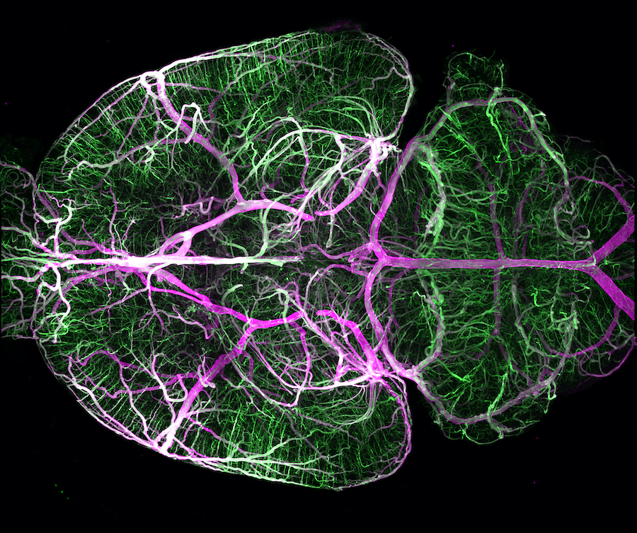 MSB: Analysis of whole brain vasculature MSB: Analysis of whole brain vasculature